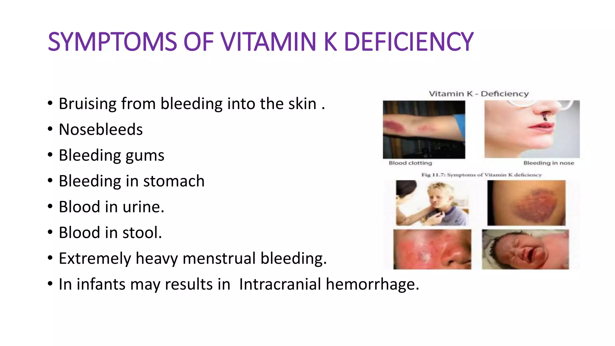 Synthesis of vitamin k presentation.pptx