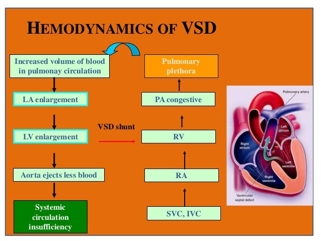vsd