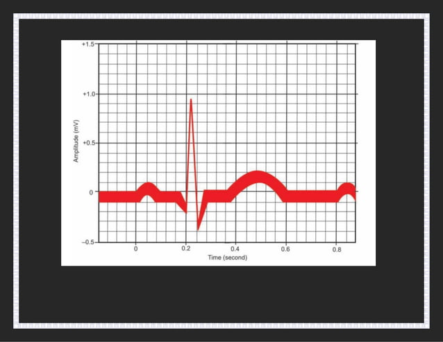 ECG ( ELECTRO CARDIO GRAPH) USE , INTRODUCTION, lead , ECG waves | PPT