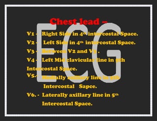 ECG ( ELECTRO CARDIO GRAPH) USE , INTRODUCTION, lead , ECG waves | PPT ...