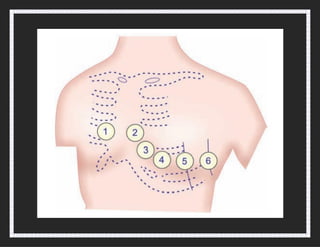 ECG ( ELECTRO CARDIO GRAPH) USE , INTRODUCTION, lead , ECG waves | PPT