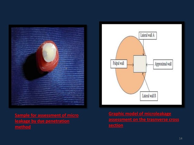 Evaluation of Marginal integrity and Depth of Cure for three ‘bulk fill ...