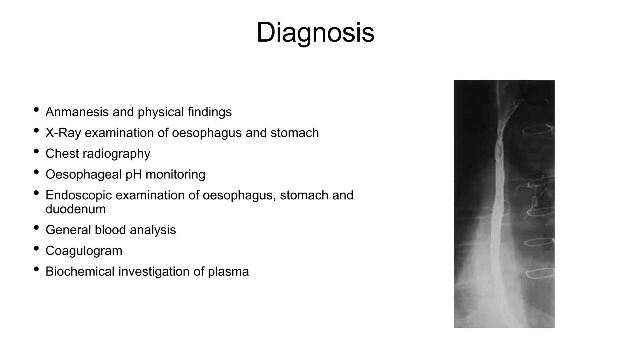 Esophageal strictures caused by caustic burns.pptx