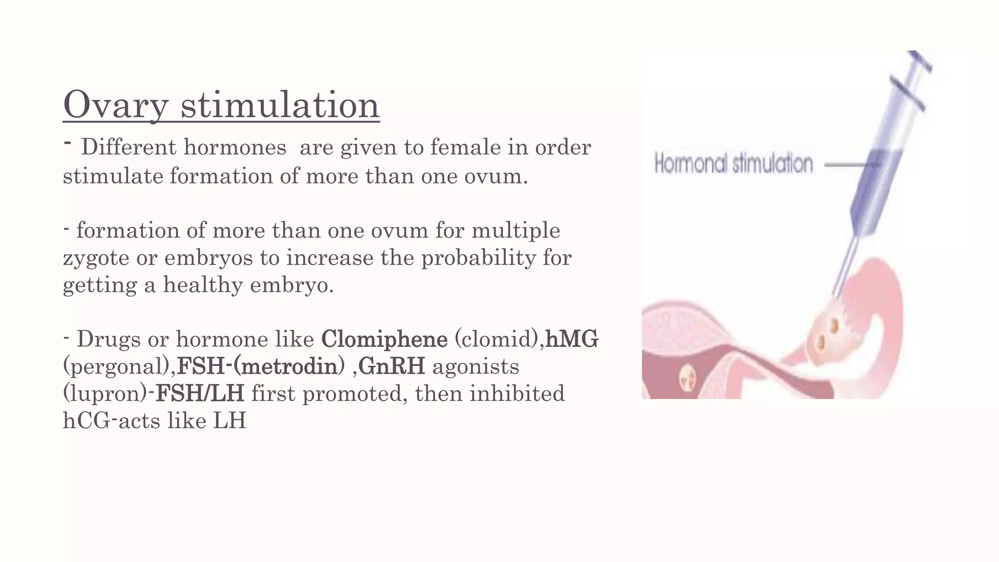 assisted reproductive technology | PPTX
