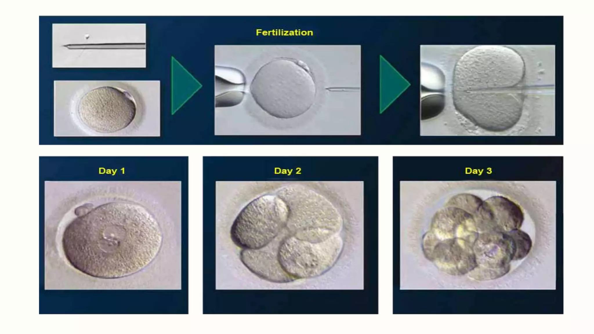 assisted reproductive technology | PPTX