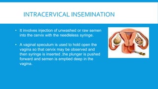 assisted reproductive technology | PPTX