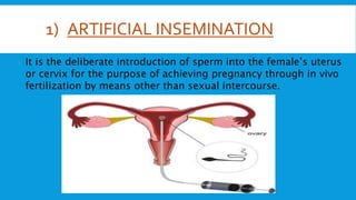 assisted reproductive technology | PPTX