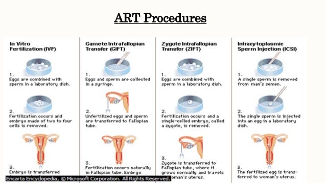 assisted reproductive technology