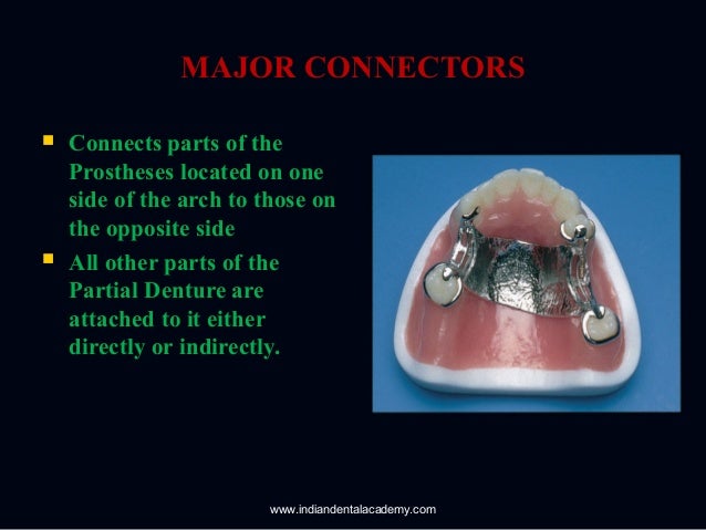 Raju major n minor connectors/certified fixed orthodontic courses by