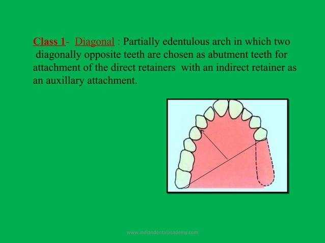 rpd classification final / dental implant courses by Indian dental ...
