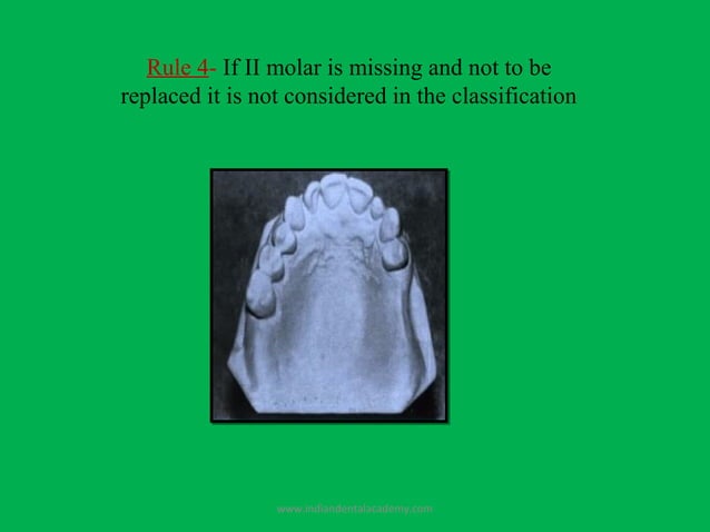 rpd classification final / dental implant courses by Indian dental ...