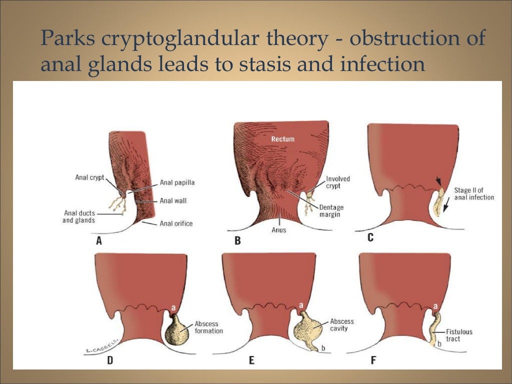 Rakesh benign-anorectal-