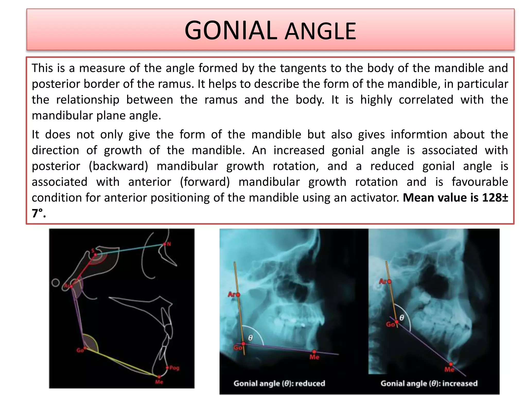 Rakosi’s analysis | PPTX