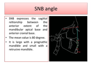 Rakosi’s analysis | PPTX