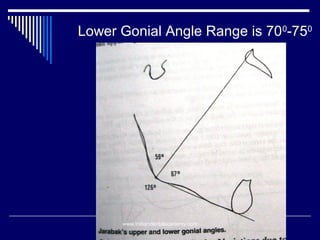 Rakosi’s analysis / dental implant courses | PPT