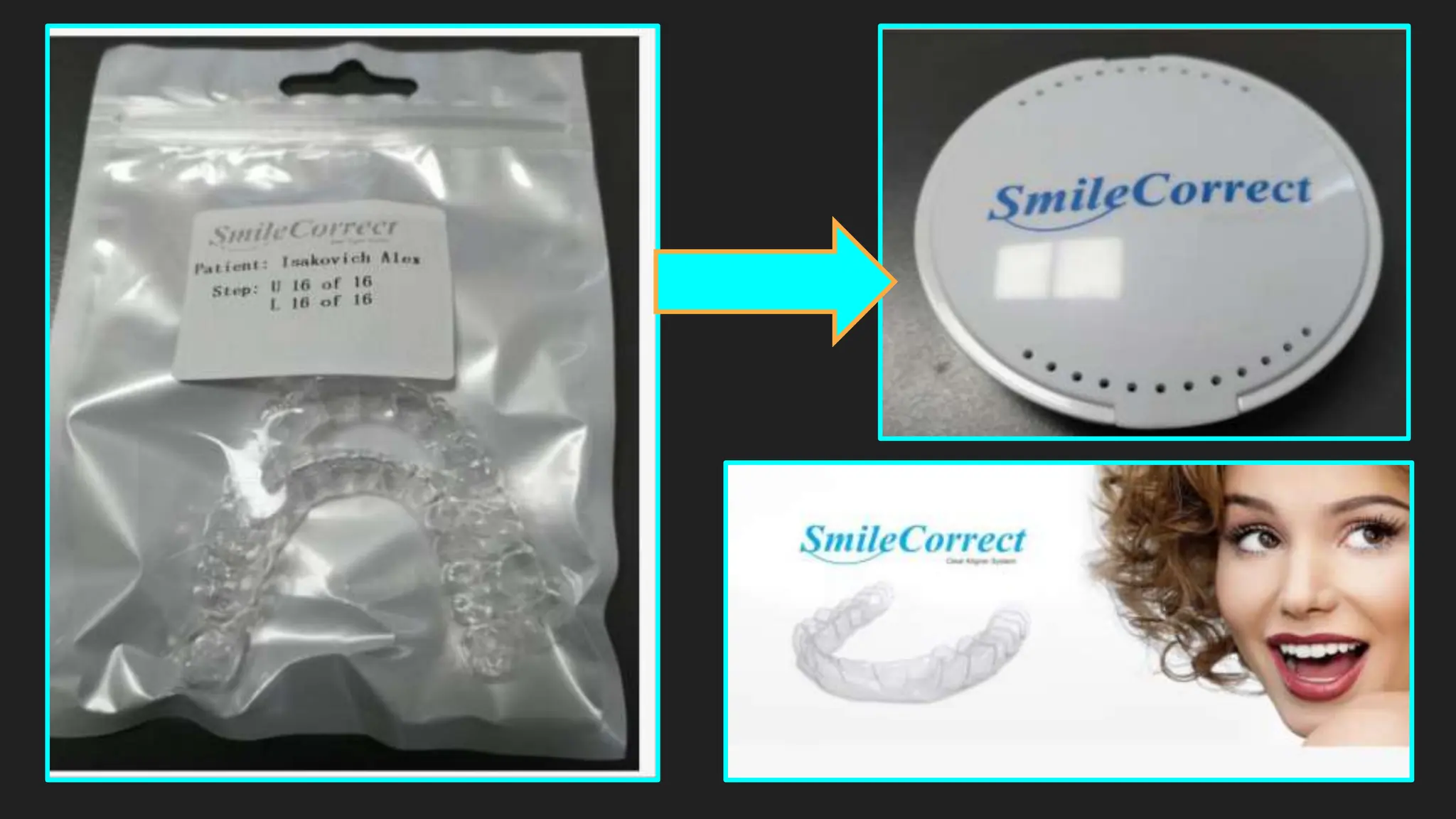 DIY Aligners.pptx