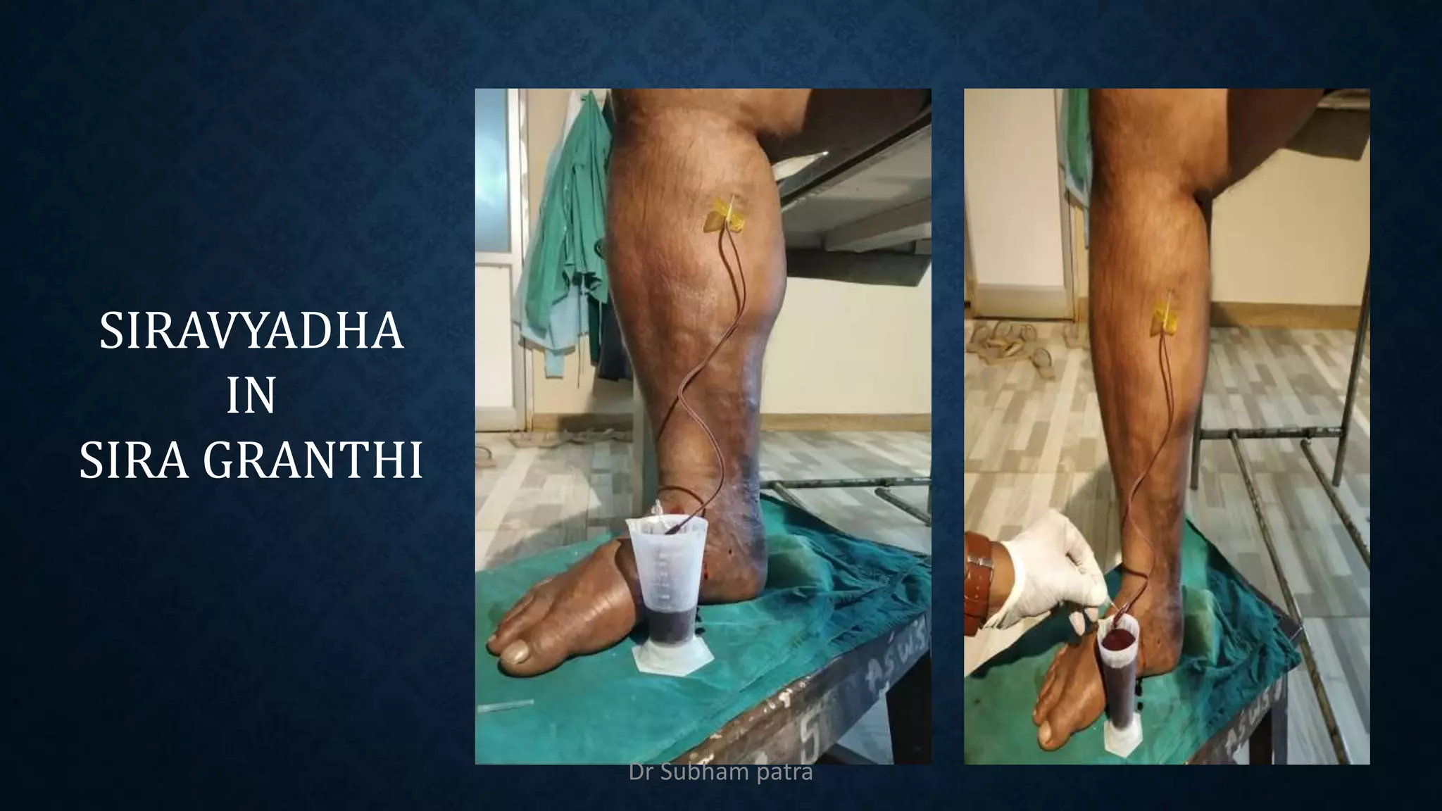 Raktamokshana-19.pptx