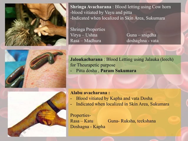 Rakta mokshana - Siravyadha | PPTX | Blood Disorders | Diseases and ...