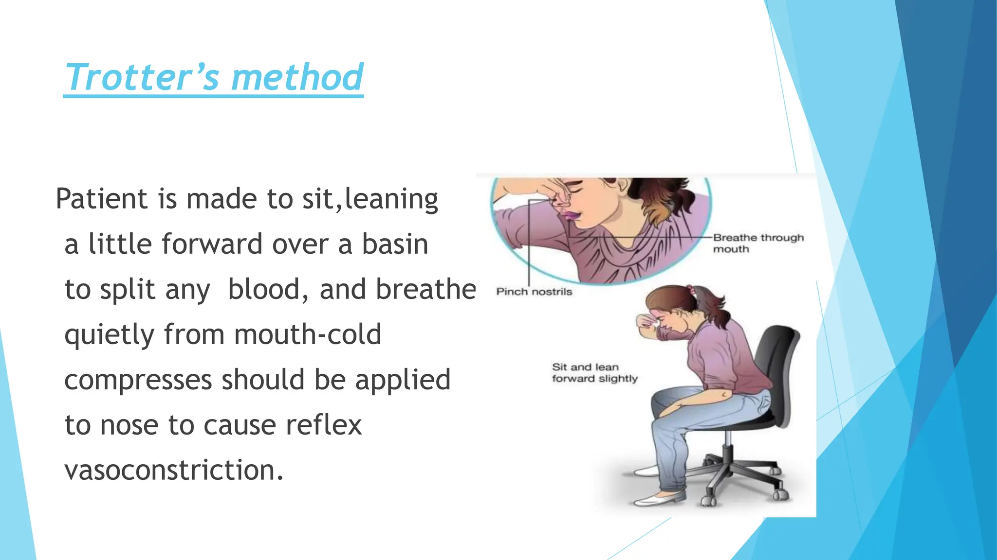 Treatment of epistaxis with their clinical features | PPTX