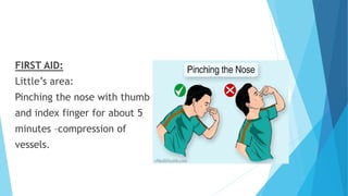 Treatment of epistaxis with their clinical features | PPTX