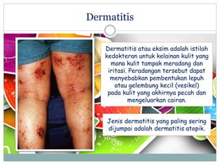 5 Istilah Kelainan Pada Penyakit ppt | PPTX
