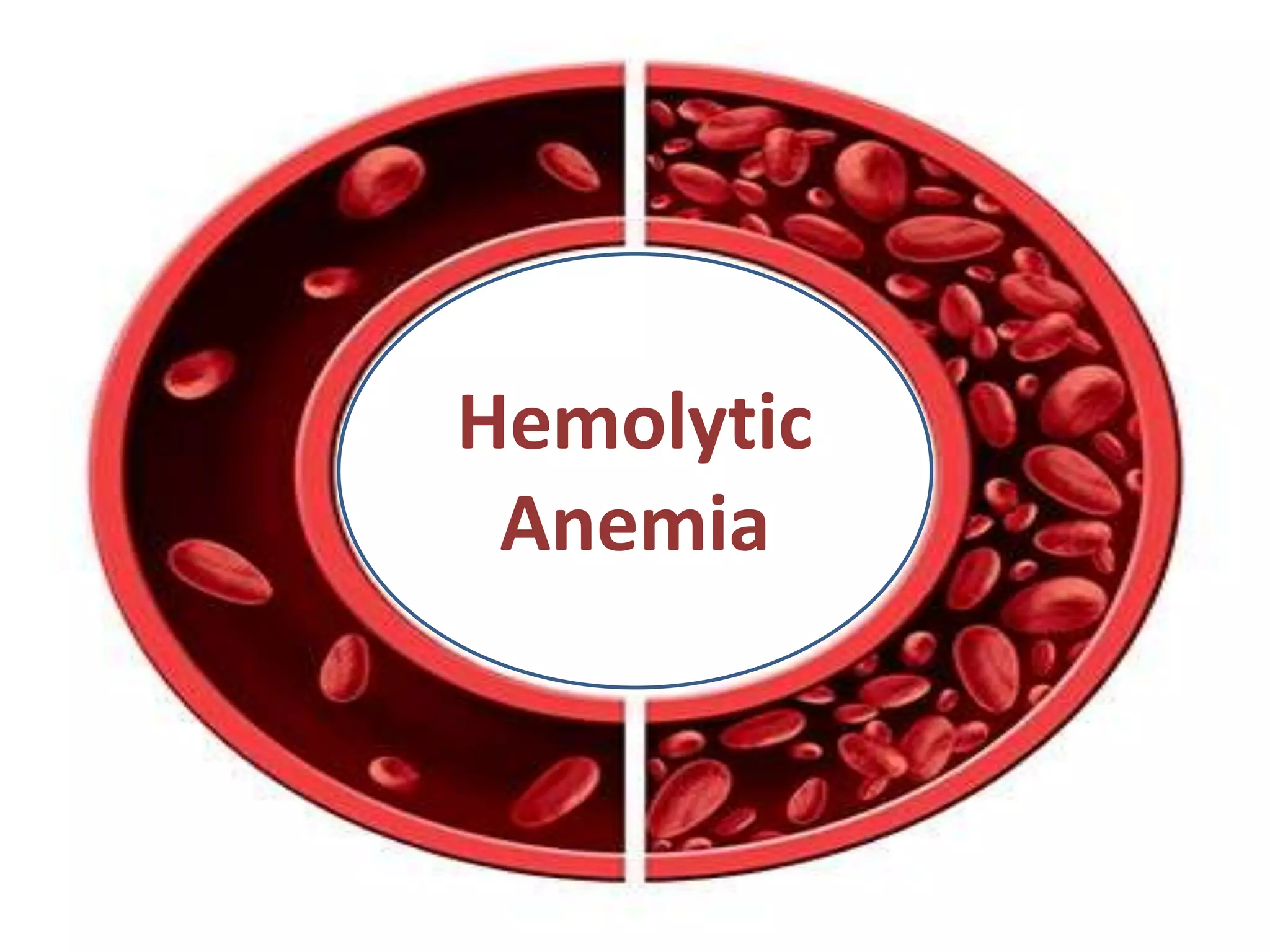 Hemophilia and Autoimmune hemolytic anemia | PPT