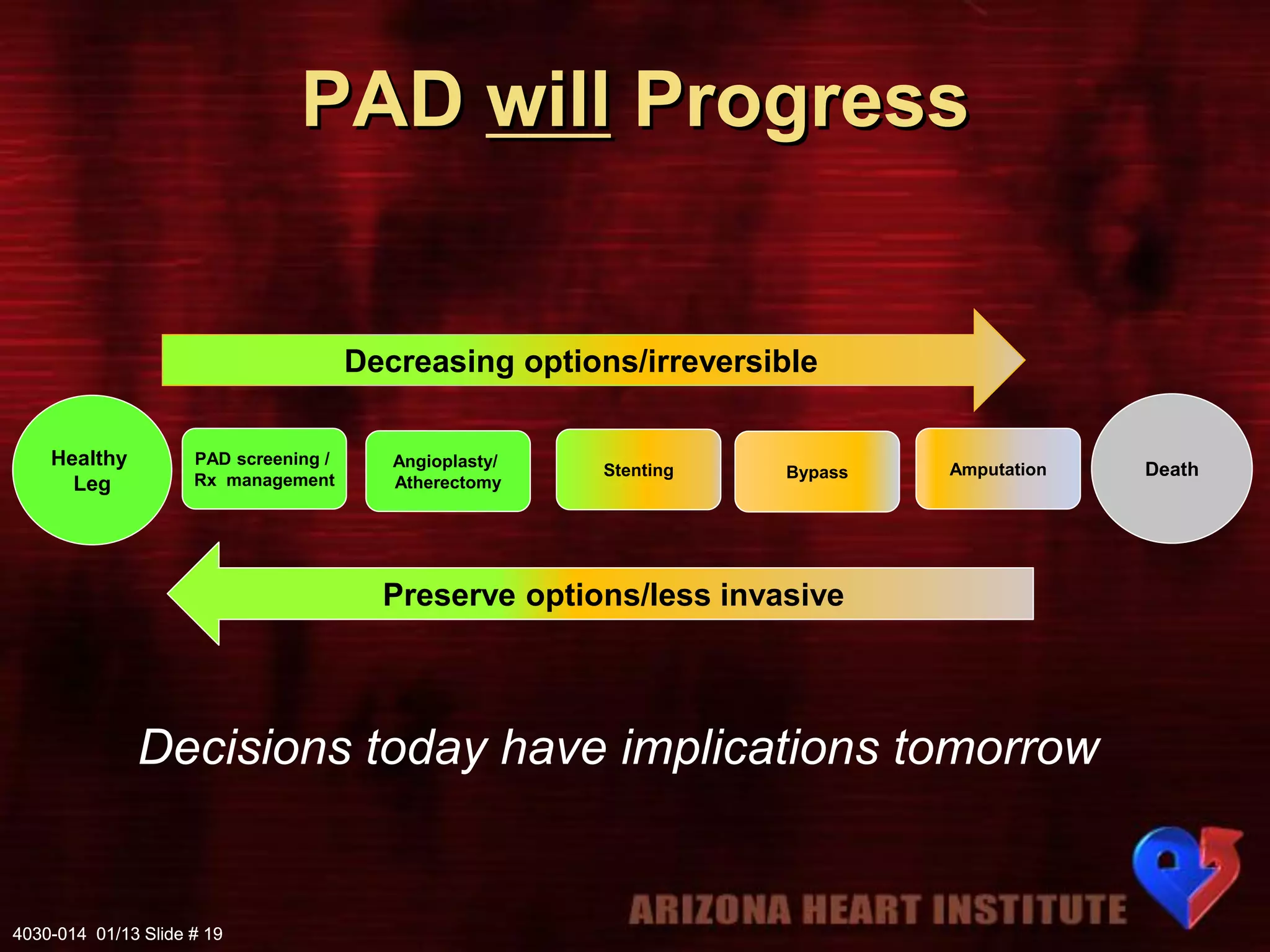 Jet Stream Pathway Device in Peripheral Arterial Disease. | PDF