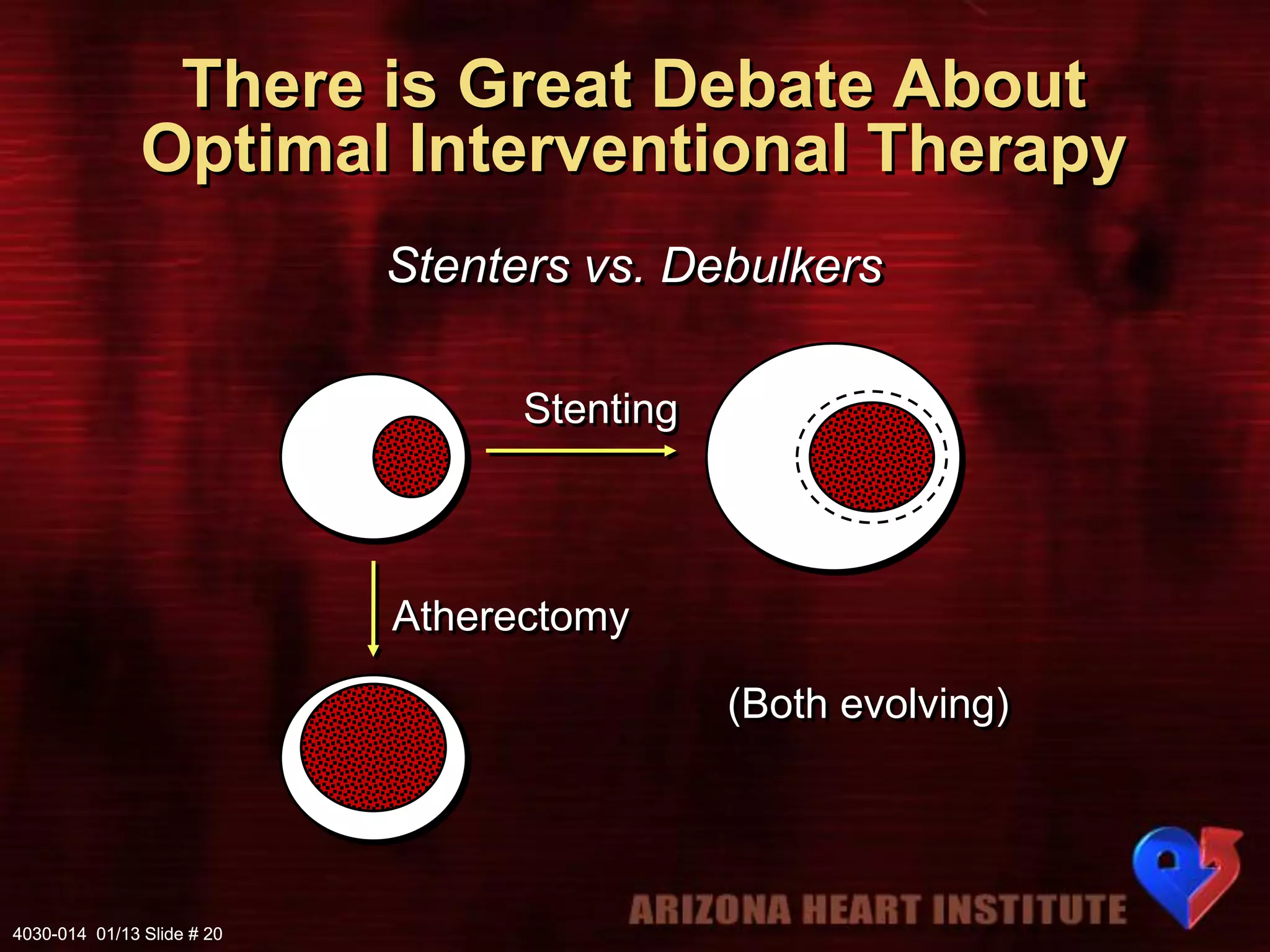 Jet Stream Pathway Device in Peripheral Arterial Disease. | PDF