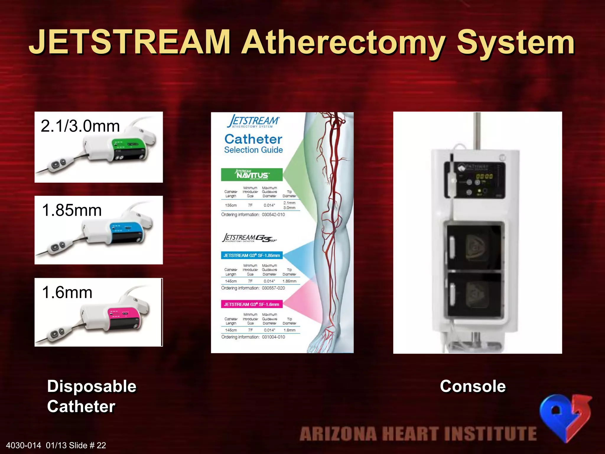 Jet Stream Pathway Device in Peripheral Arterial Disease. | PDF