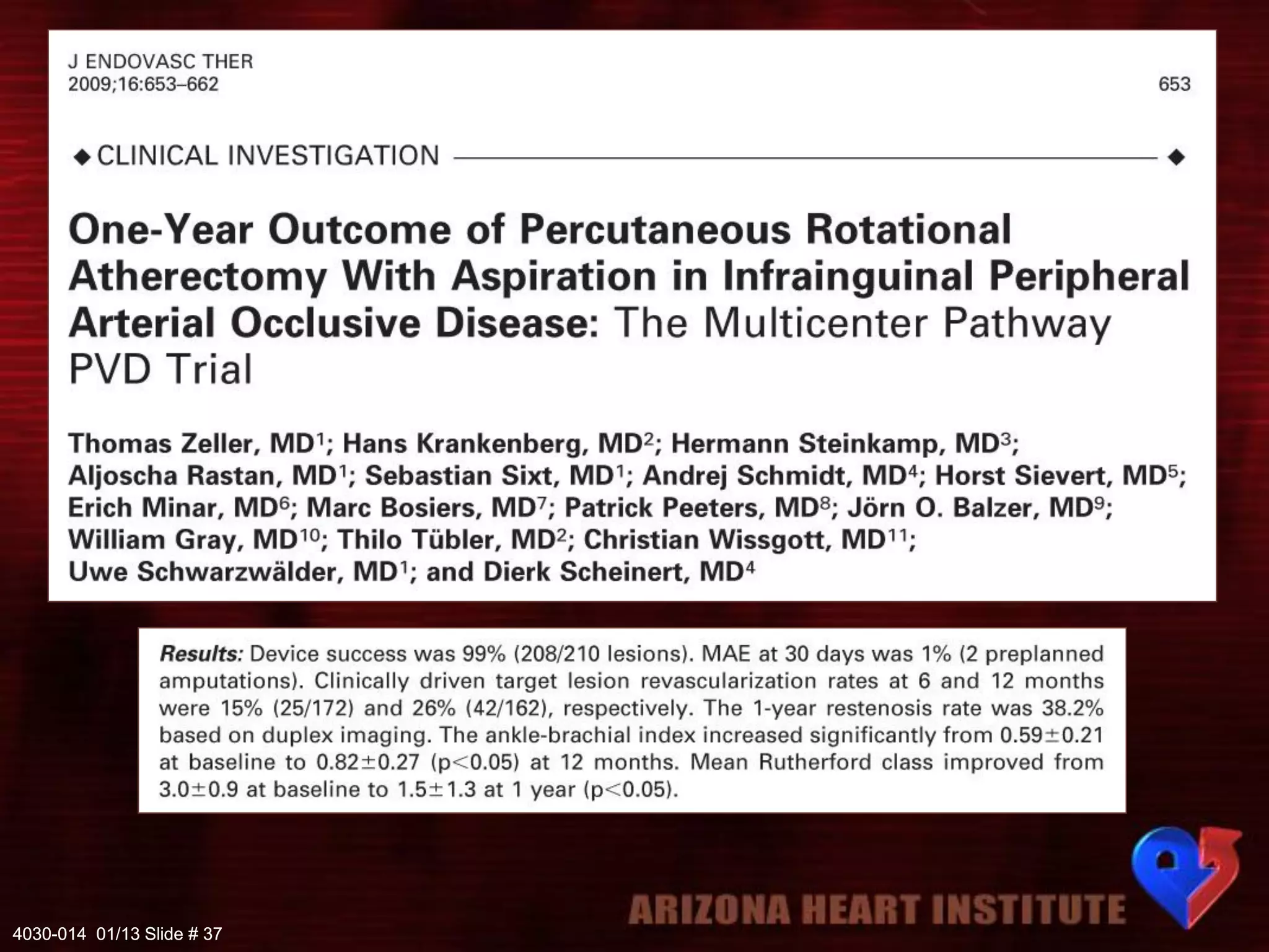 Jet Stream Pathway Device in Peripheral Arterial Disease. | PDF