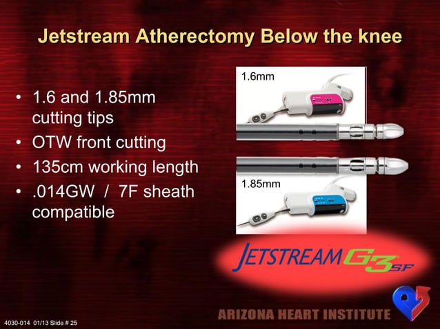 Jet Stream Pathway Device in Peripheral Arterial Disease. | PDF