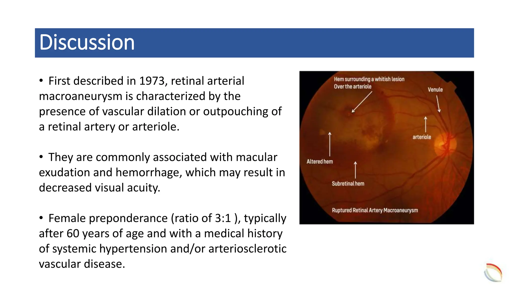 Retinal Artery Macroaneurysm Pptx Eye And Vision Conditions Diseases And Conditions