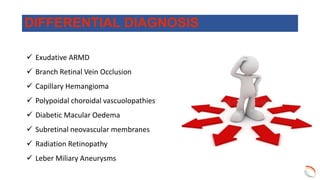 Retinal Artery Macroaneurysm | PPTX