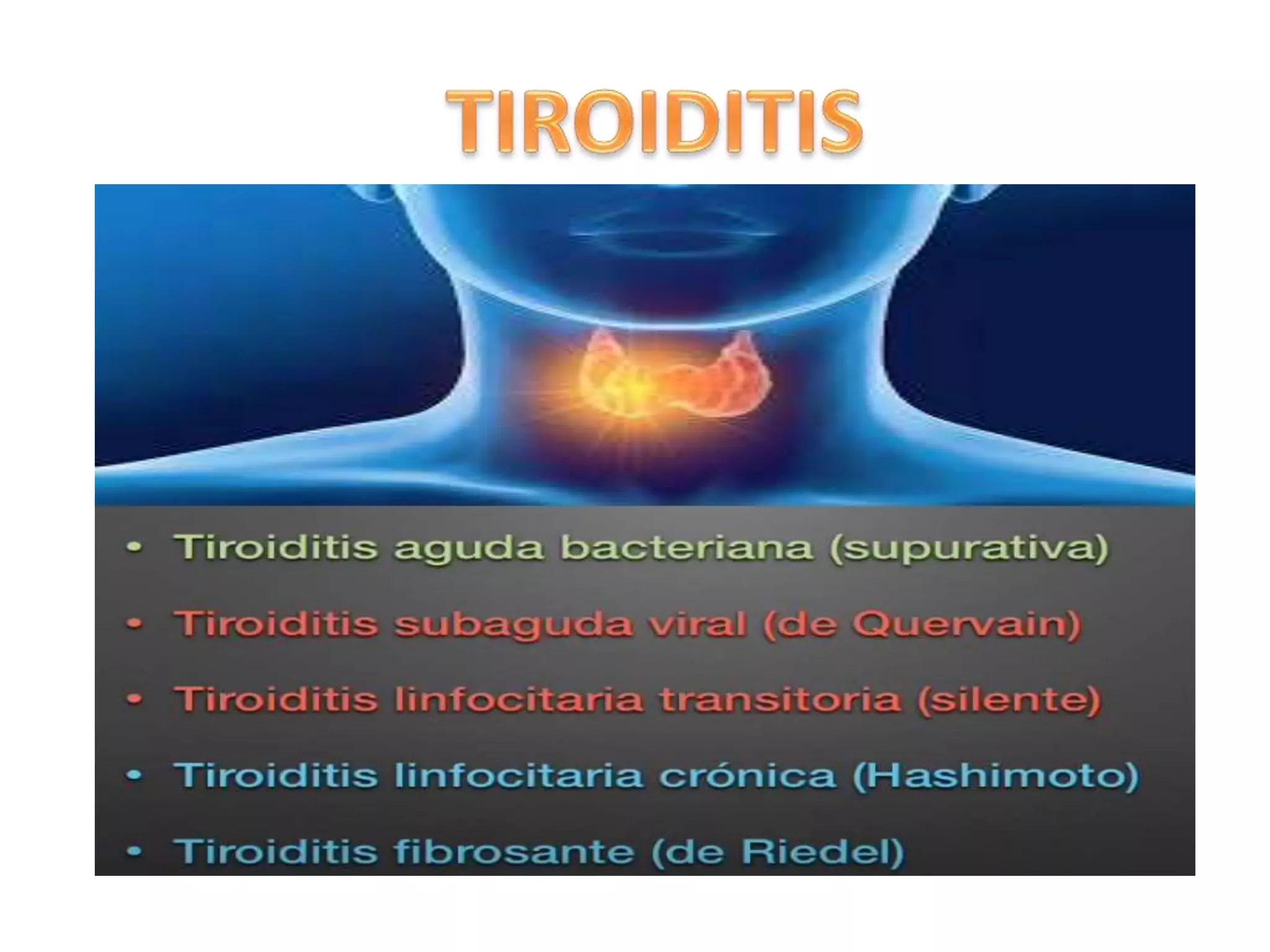 TIROIDITIS | PPTX