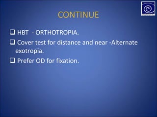 Ramji pandey EXOTROPIA PPT | PPTX