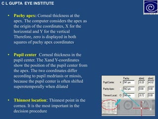 corneal topography by ramji pandey ...C L GUPTA eye institute | PPTX