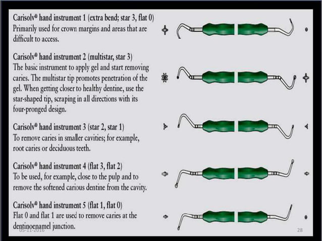 Rampant caries and chemico machanical removal of caries | PPTX