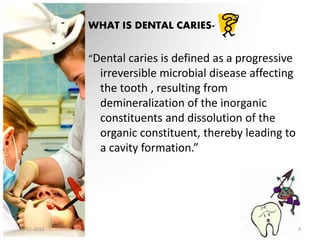 Rampant caries and chemico machanical removal of caries | PPTX