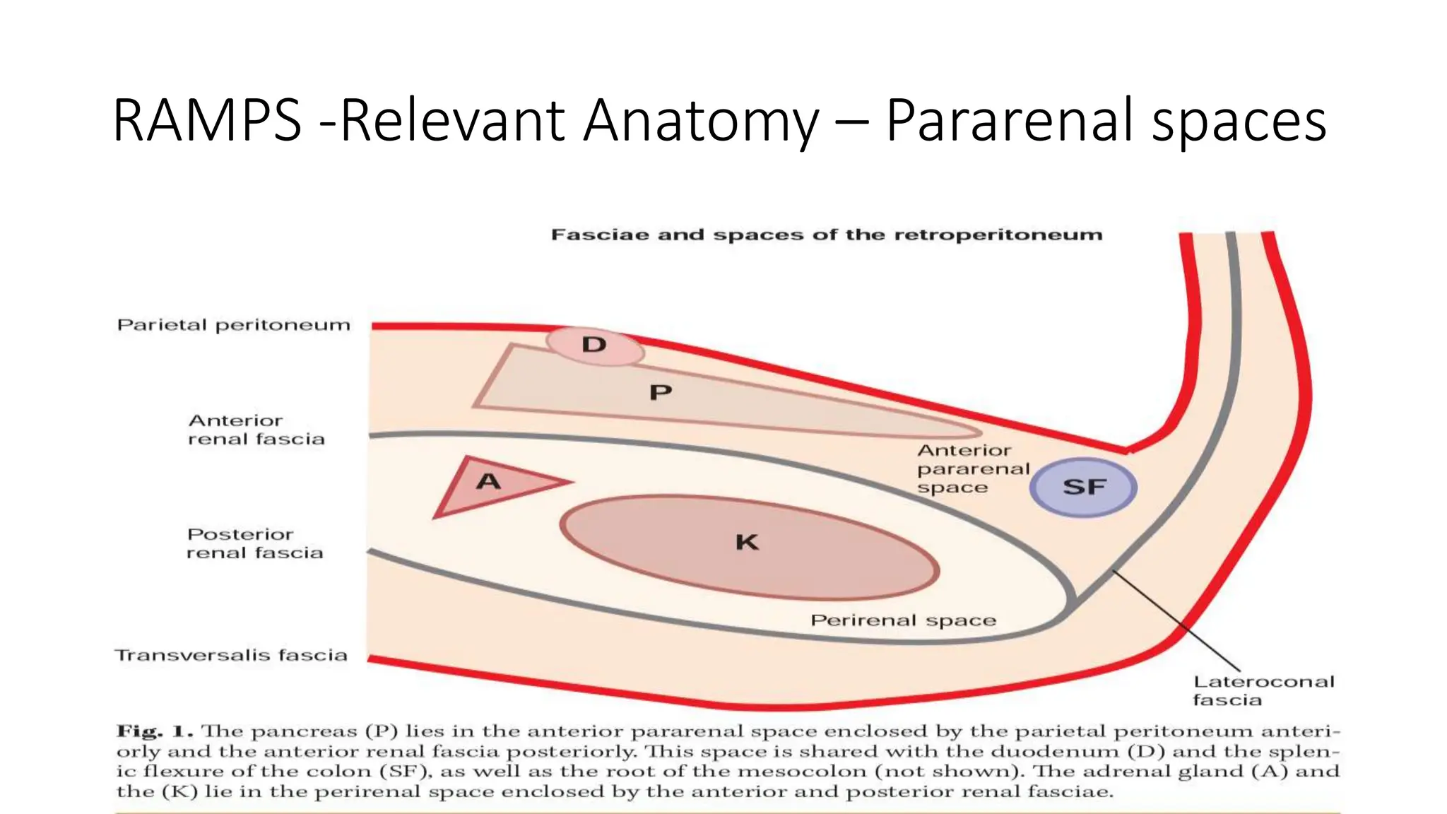 RAMPS.pptx surgery of pancreas done for radical resection | PPTX