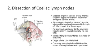 RAMPS.pptx surgery of pancreas done for radical resection | PPTX