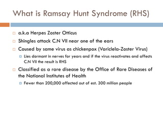 Ramsay Hunt Syndrome (RHS) | PDF