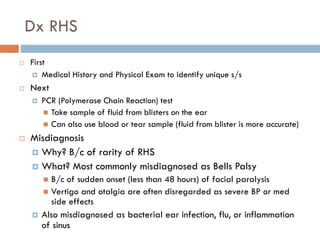 Ramsay Hunt Syndrome (RHS) | PDF