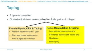 Ram’s Taping for talipes | PPTX