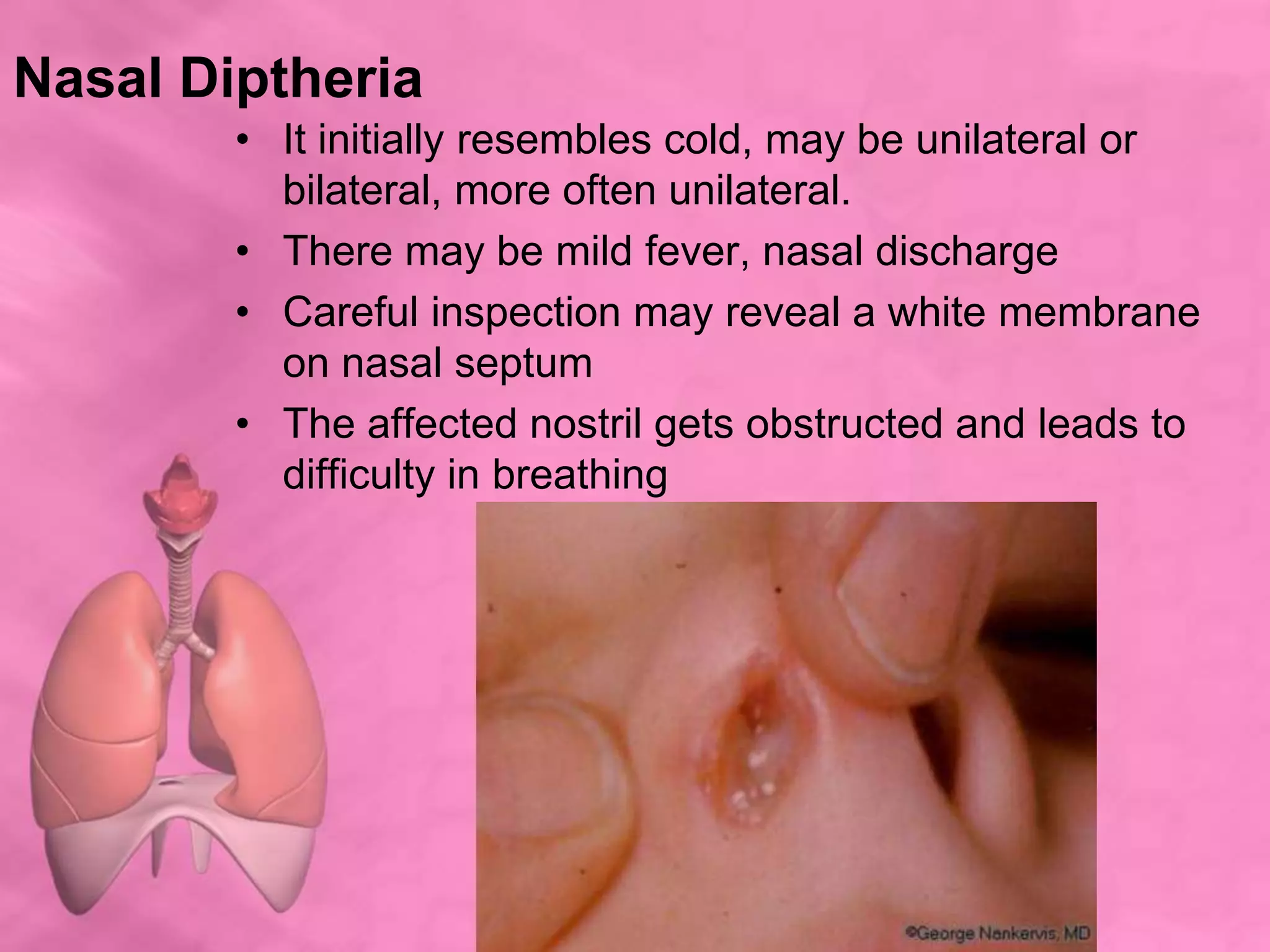 Upper And Lower Airway Obstruction Ppt