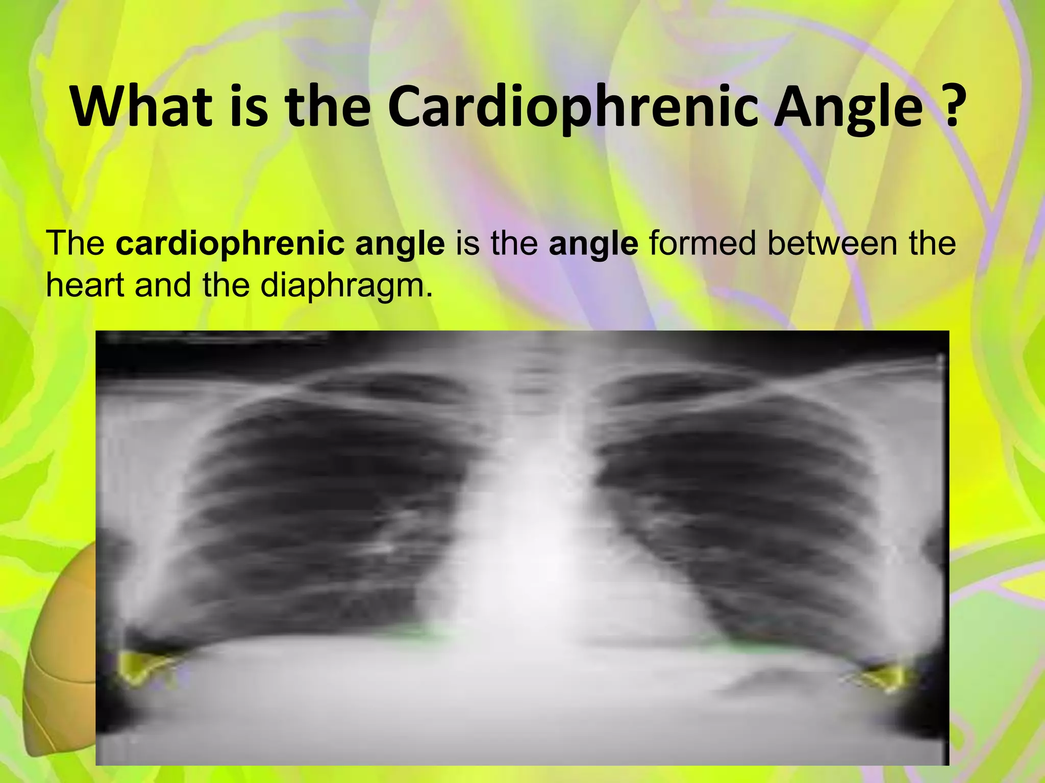 Cardiophrenic angle | PPTX