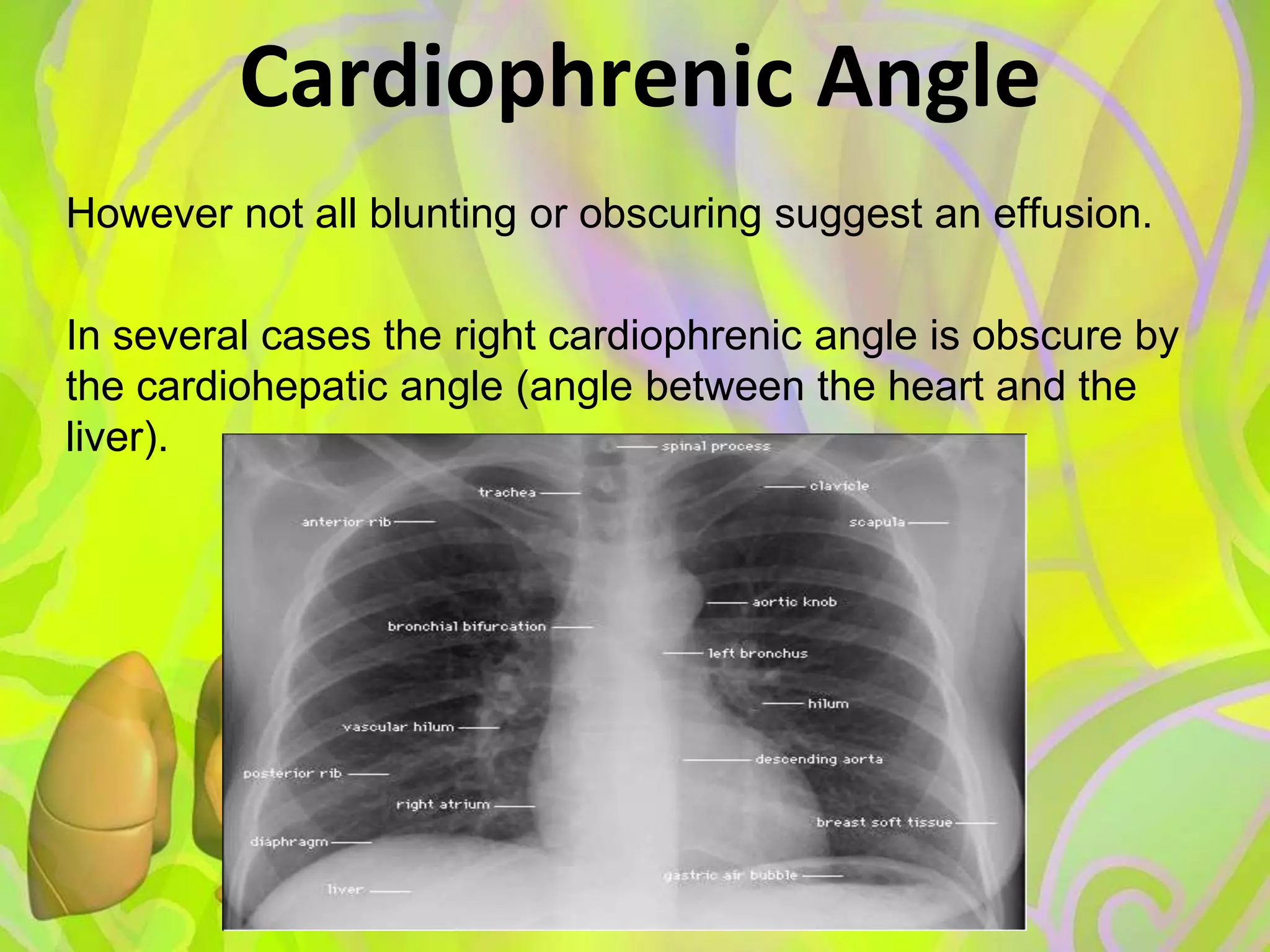 Cardiophrenic angle | PPTX
