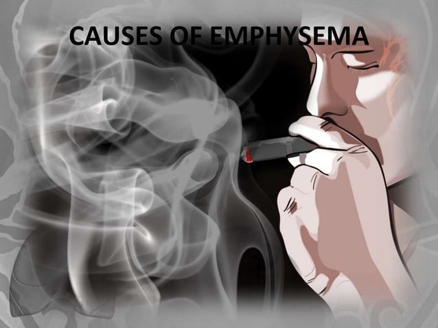 Emphysema | PPTX