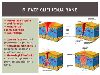 Rana i cijeljenje rane | PPSX