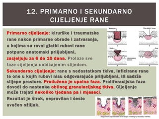 Rana i cijeljenje rane | PPSX