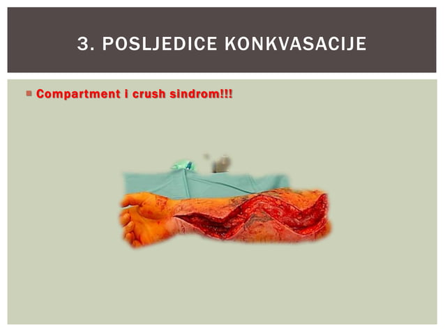 Rana i cijeljenje rane | PPSX